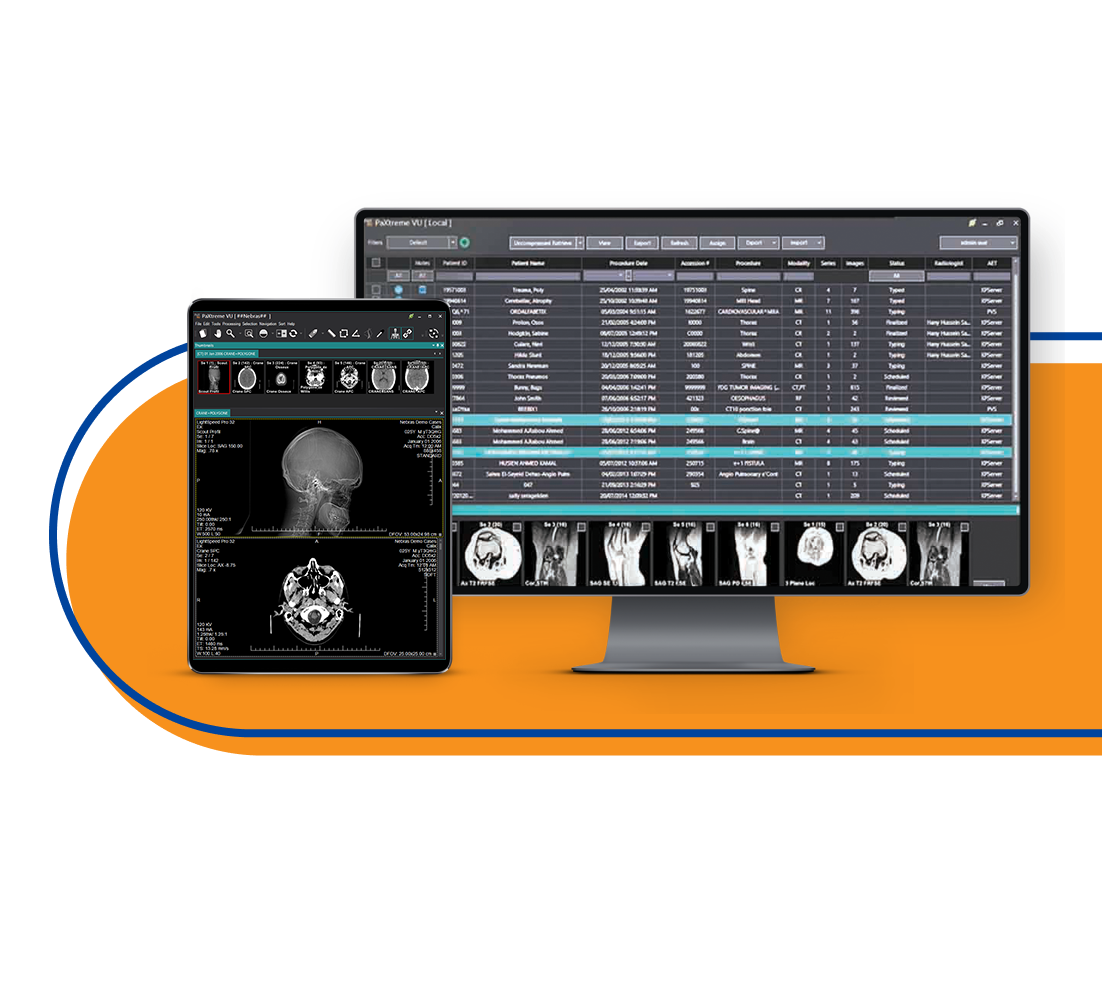 Paxtreme – Nebras Technology